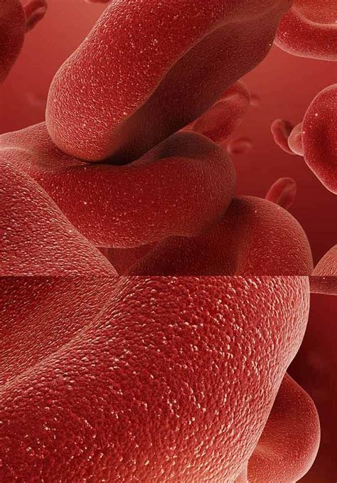 Erythrocyte Morphology And Its Disorders Intechopen