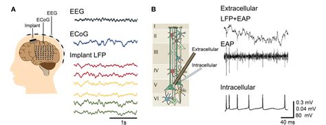 Figure 1 From Revealing Neuronal Function Through Microelectrode Array