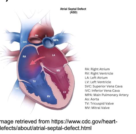 Cvp Application In Pediatric Populations Flashcards Quizlet
