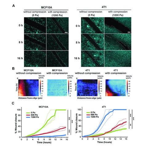 compressive stress inhibits migration in mcf10a cells and enhances