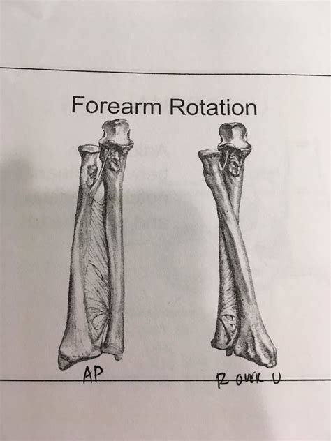 Kinesiology Forearm Rotation Diagram Quizlet