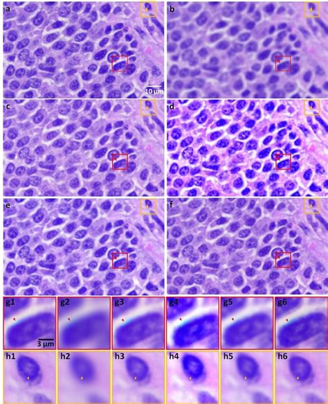 Comparison Of The Results For Our Deep Learning Model Based On Resnext Download Scientific