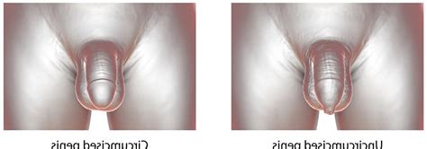 La Kératinisation Comprendre Et Prévenir Les Troubles Cutanés Eln