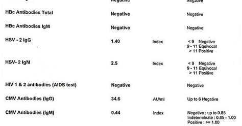 Imgur The Magic Of The Internet