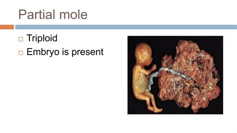 Histology Of The Placentapptx