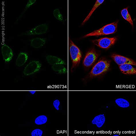 Anti Ythdf1 Ythdf3 Ythdf2 Antibody [epr26183 69] Bsa And Azide Free Ab290749 Abcam