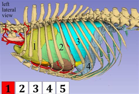 Echocardiogram Flashcards Quizlet