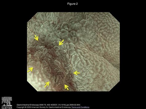 Response Gastrointestinal Endoscopy Ppt Download
