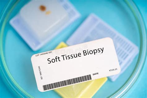 Soft Tissue Biopsy Stock Image Image Of Sample Soft 277040609