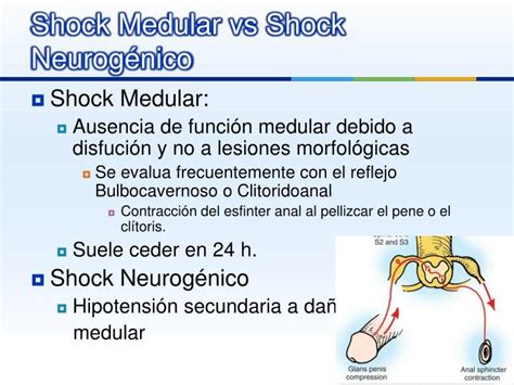 Ppt Trauma Raquimedular Powerpoint Presentation Id935186