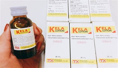 Mua Thuốc Kela Lotion Thái Lan ở đâu chính hãng?