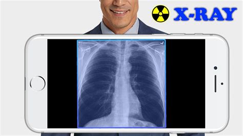 X Ray Filter Photo Apk For Android Download