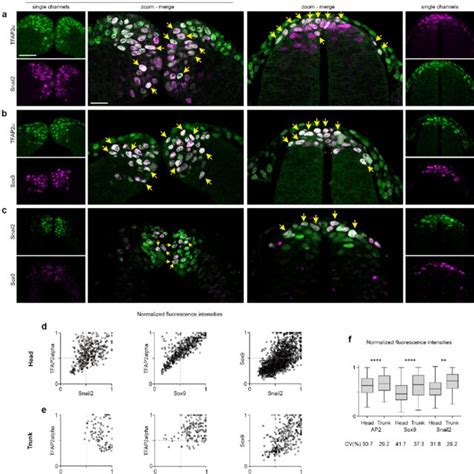 Differential Heterogeneity Of Cephalic And Trunk Neural Crest Cells Download Scientific Diagram