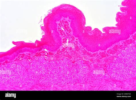 Keratinized Stratified Squamous Epithelium The Simple Stratified