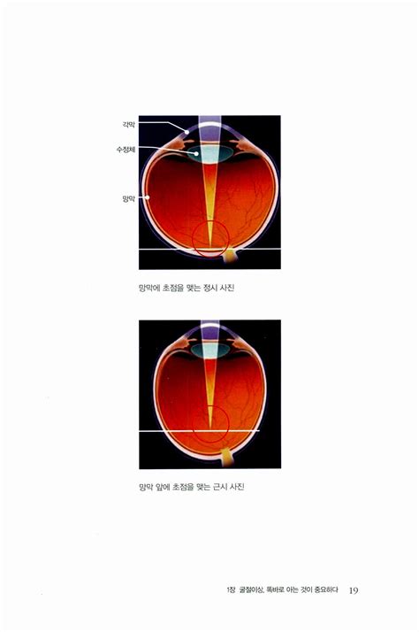알라딘 미리보기 병원 가기 전에 꼭 알아야 할 안과질환의 모든 것