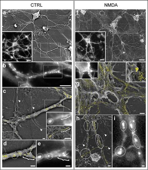 Correlative Light High Resolution Scanning Electron Microscopy