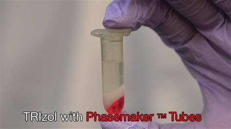 Trizol Rna Extraction Kit At Amy Ammerman Blog