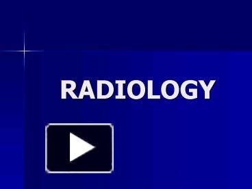 PPT RADIOLOGY PowerPoint Presentation Free To View Id Dbd Y ZkM