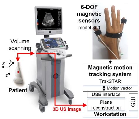 Block Diagrams Of The Developed Volume Navigating System Download