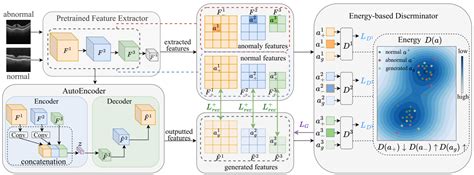 논문 리뷰 Boosting Fine Grained Visual Anomaly Detection With Coarse Knowledge Aware Adversarial