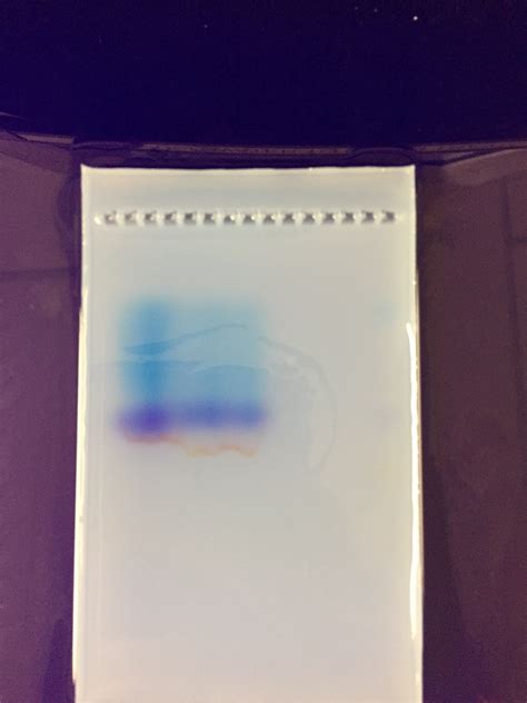 I Am Trying To Standardize Chipseq Protocol Can Anyone Explain This Gel Researchgate