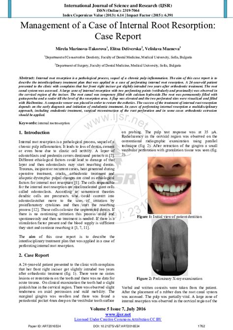 Pdf Management Of A Case Of Internal Root Resorption Case Report Mirela Marinova Takorova