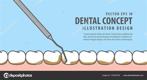 Banner Scaling Teeth Illustration Vector On Blue Background Den