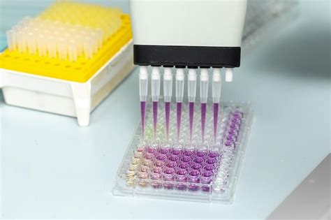 Premium Photo Antioxidant Activity On Microplate With Dpph Radical