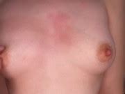 Spanked Boobs And Massaged Beautiful Breasts Xxx Mobile Porno Videos Movies Iporntv Net