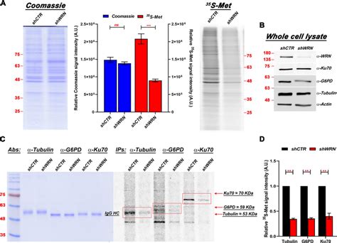wrn depletion affects de novo synthesis of proteins a pulse labeling