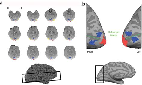 Rois In One Example Subjecta Native Functional Slices 415 See