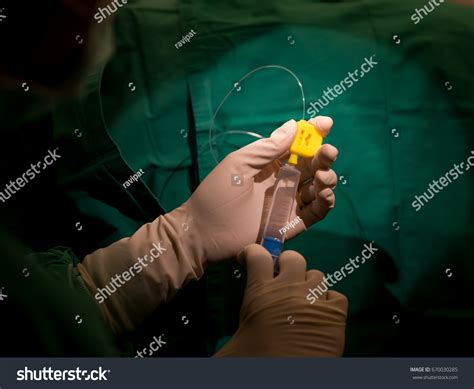 Epidural Analgesiaepidural Nerve Blockdoctor Put Medicine Foto Stok 670030285 Shutterstock
