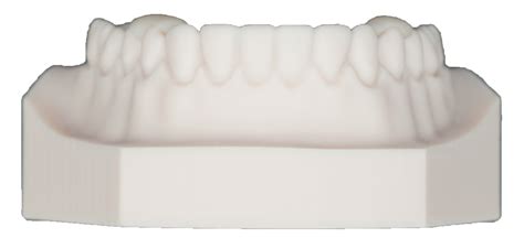 Retainers Archives Protec Dental