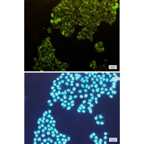 Fructose 6 Phosphate Kinase Rabbit Mab Wb Iccif Buy Now