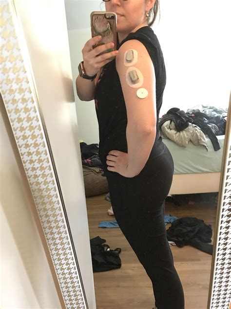 463 Best Freestyle Libre Images On Pholder Freestylelibre Diabetes And Diabetes T1