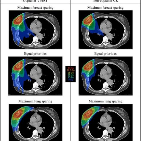 Dose Distributions For An Example Case The Dose Distributions On The