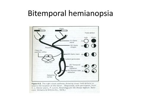 Ppt Endocrine Physiology And Pathophysiology Powerpoint Presentation