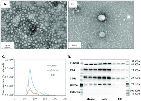 Characterization Of The Evs Isolated By Evrich Ab The Transmission