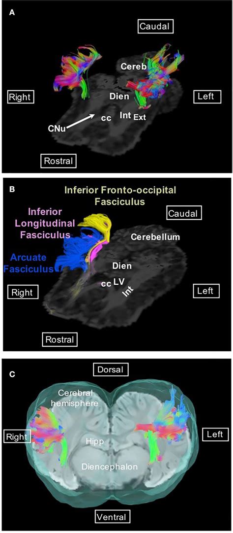 Arcuate Fasciculus A Dorsal View Of The Arcuate Fasciculus