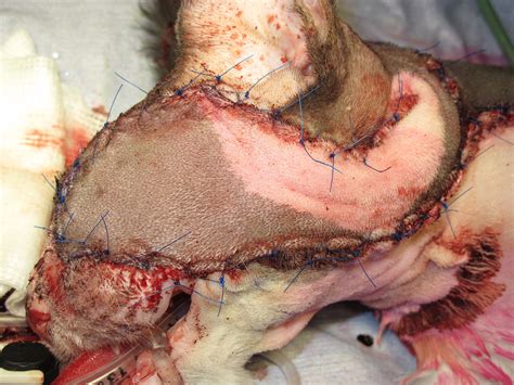 Reconstruction Axial Pattern Flaps — Dr Julius M Liptak