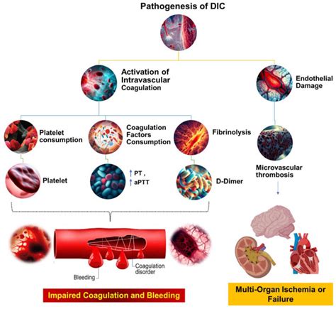 Pathophysiology Of Disseminated Intravascular Coagulation In Sepsis A