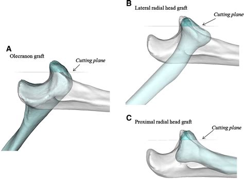 Three Dimensional Suitability Assessment Of Three Types Of