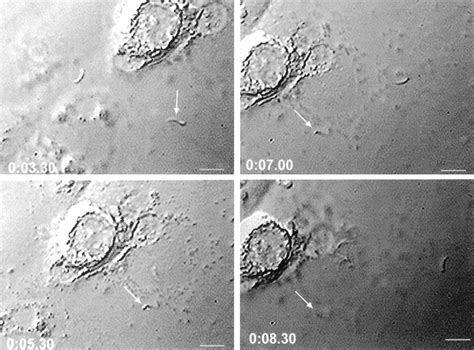 Cryptosporidium Parvum Apical Complex Glycoprotein Csl Contains A