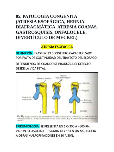05 PatologÍa CongÉnita Atresia EsofÁgica Hernia DiafragmÁtica