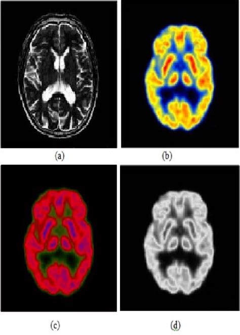Figure 2 From An Effective Approach In Fusion Of Multispectral Medical