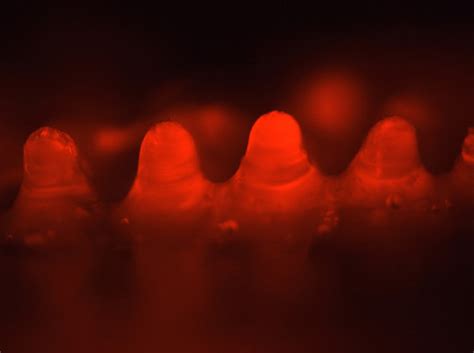 Microneedle Flu Patch By Georgia Institute Of Technology Inhabitat Green Design Innovation