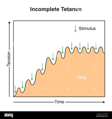 Scientific Designing Of Incomplete Tetanus Colorful Symbols Vector Illustration Stock Vector