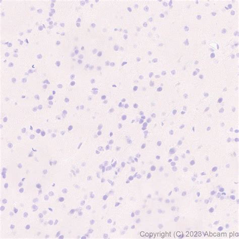 Anti Streptococcus Mutans Glucan Binding Protein Antibody Epr28235 85