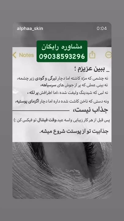 اگه تا عید پوست خوب و چهره جوان و زیبا میخوایناز الان باید شروع کنین