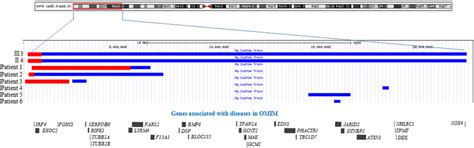 A Contiguous Deletion And Duplication In Chromosome 6p Regions Of Our